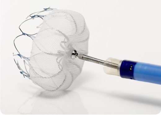 AMULET vs. WATCHMAN: os dispositivos de oclusão do apêndice atrial ...