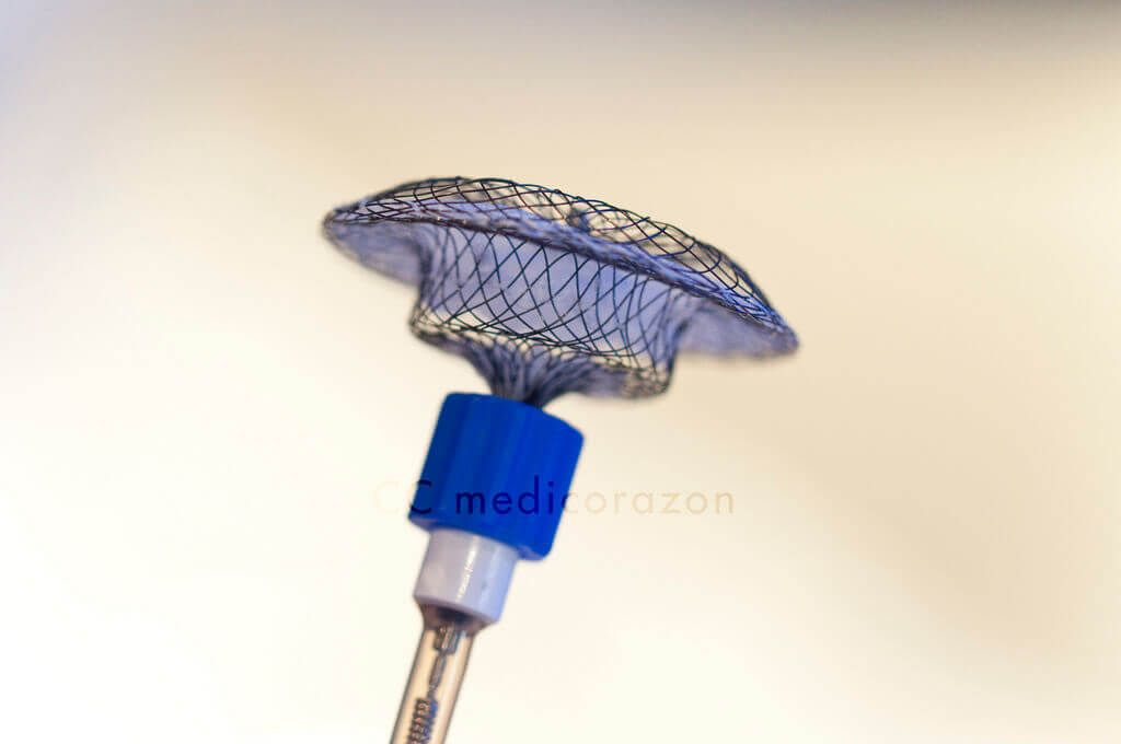 AMULET IDE: Un nuevo estudio compara los dispositivos Watchman y Amulet ...