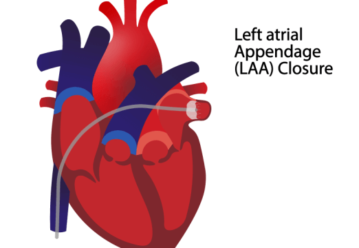The Two Sides of the Coin: What Do CHAMPION-AF and CLOSURE-AF Teach Us ...