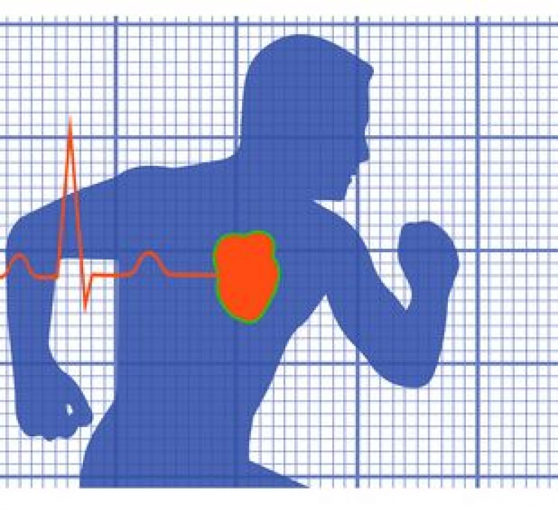 Supervised exercise is as important as revascularization in aortoiliac ...